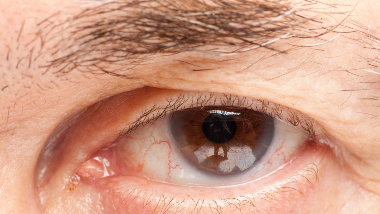What Are the Warning Signs of Eye Diseases? A Guide to Early Detection ...